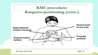 Kangaroo mother care | PDF