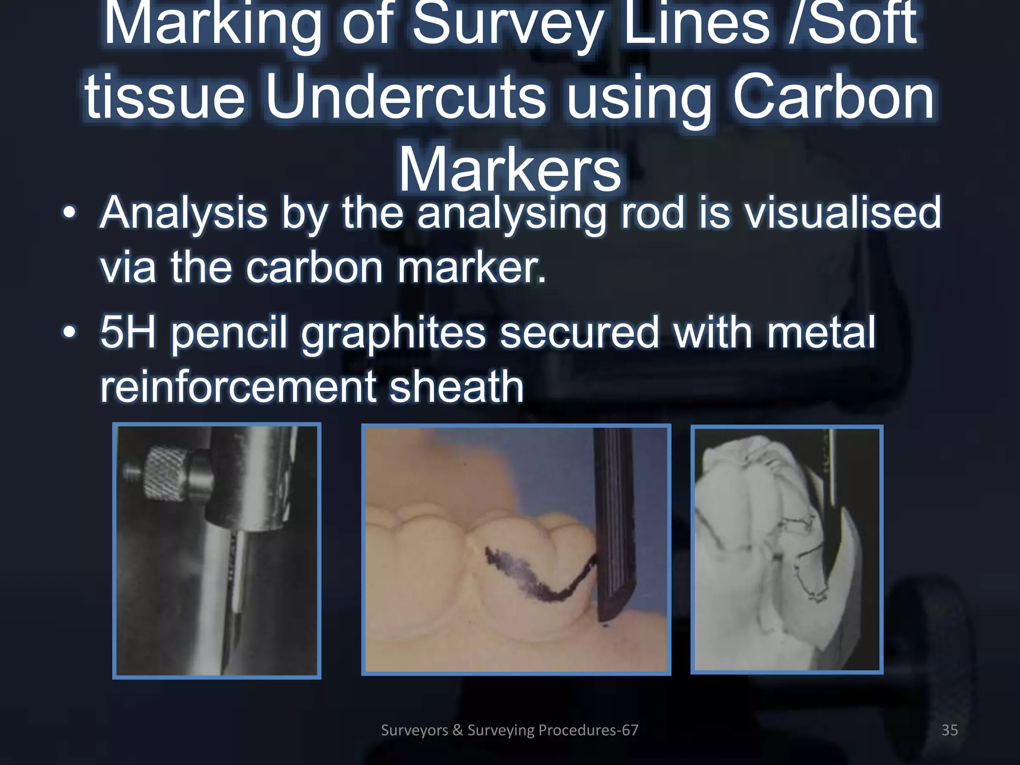 SURVEYORS & SURVEYING PROCEDURES IN REMOVABLE PARTIAL PROSTHODONTICS | PPTX