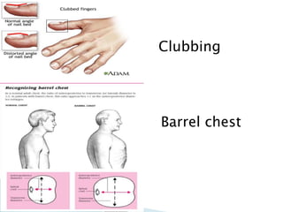 Respiratory and obstetric emergencies management | PPT