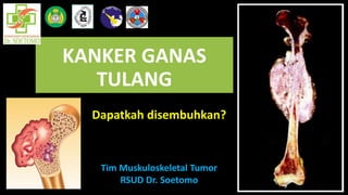 Kanker ganas tulang jatim fair 2017 | PPTX
