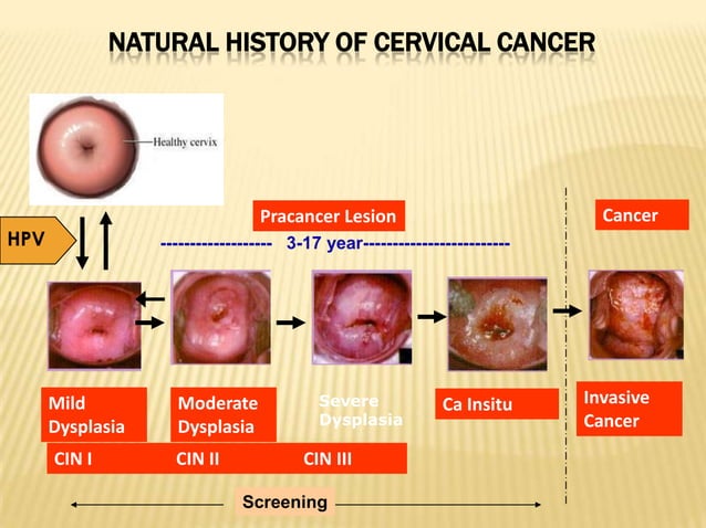 Kanker Leher Rahim dan Pencegahannya | PPTX