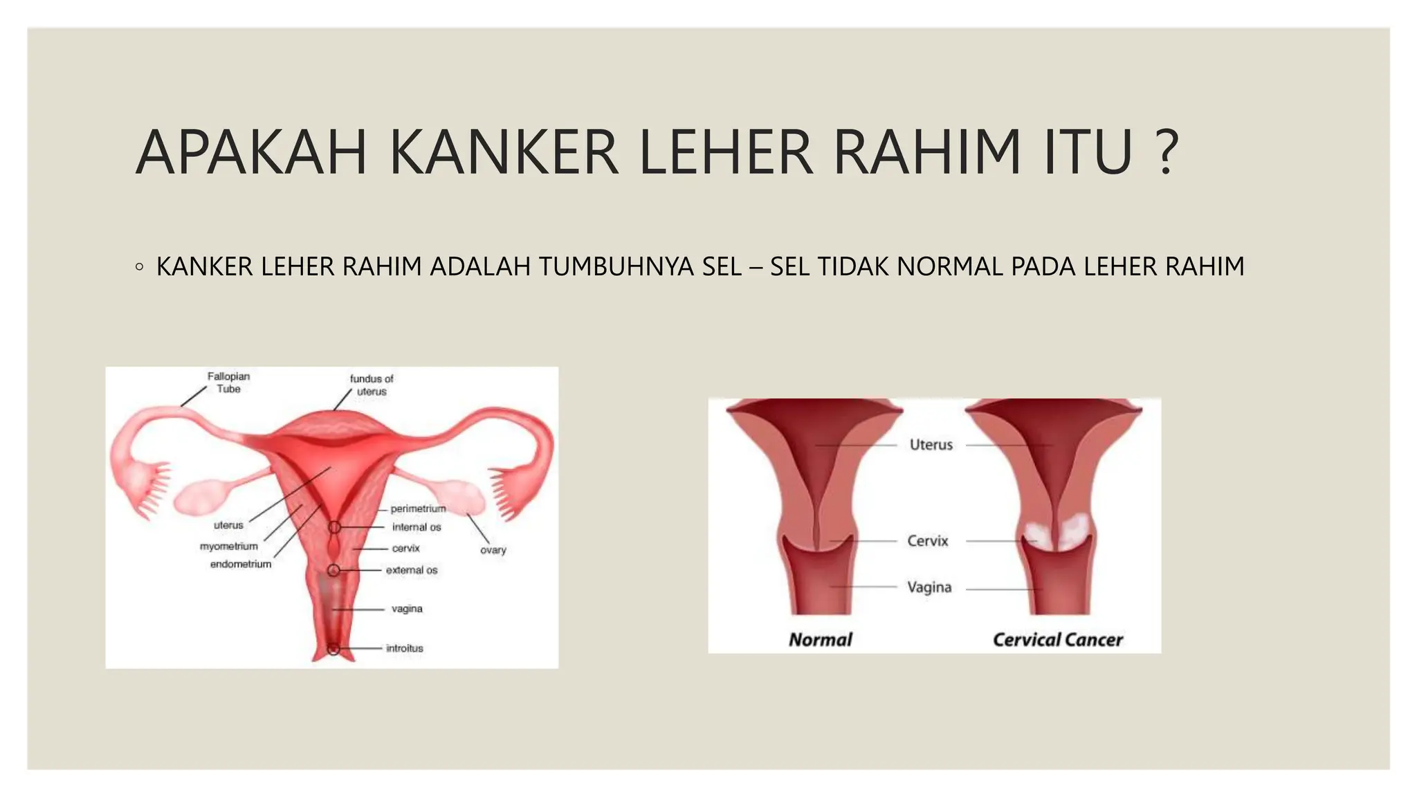 KANKER LEHER RAHIM mmmmmmmmmmmmmmmmmmmmmmm | PPT