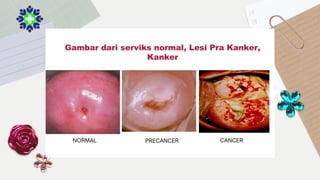 Penyuluhan Kenyakit Kanker Mulut Rahim atau Kanker Serviks | PPTX
