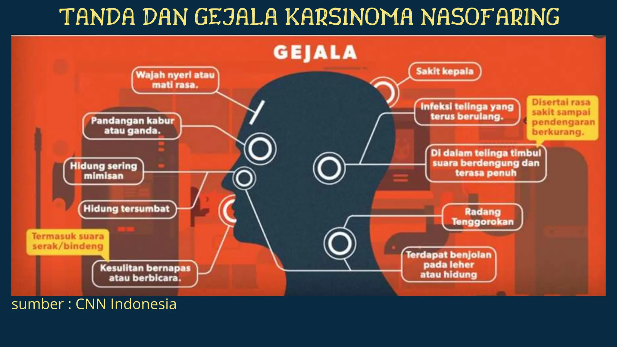 Kanker nasofaring.pptx
