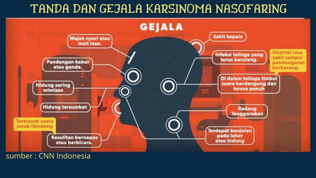 Kanker nasofaring.pptx