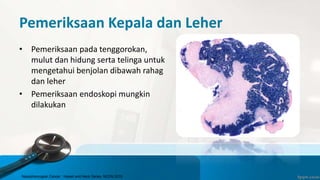 KANKER NASOFARING lecture ear nose throa | PPTX
