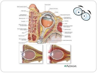 Kanker orbita | PPTX