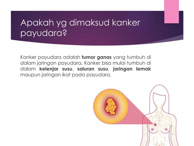 Kanker Payudara/Breast Cancer Presentasi PPT | PPTX