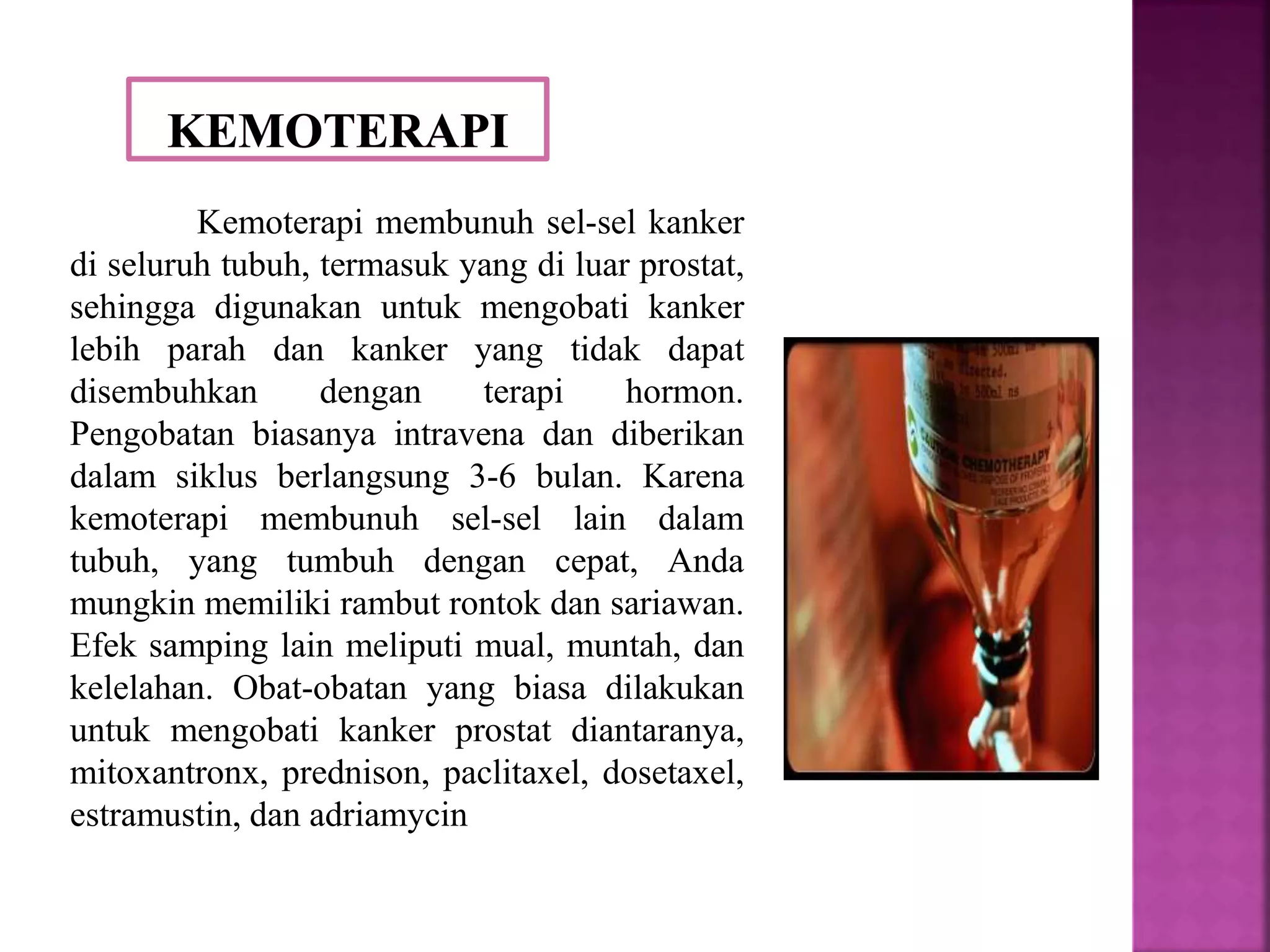 Kanker prostat power point | PPTX