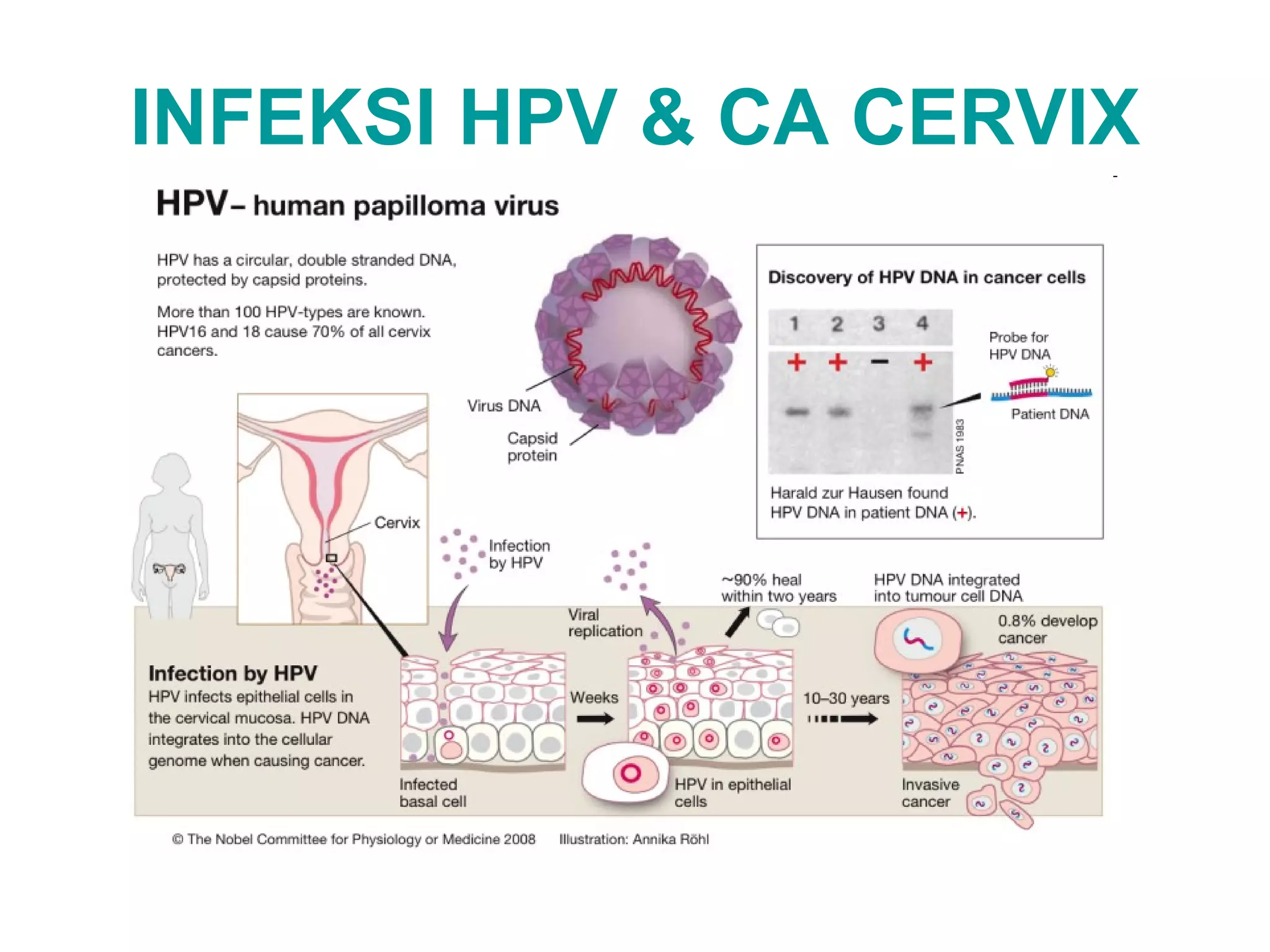 Kanker serviks | PPT