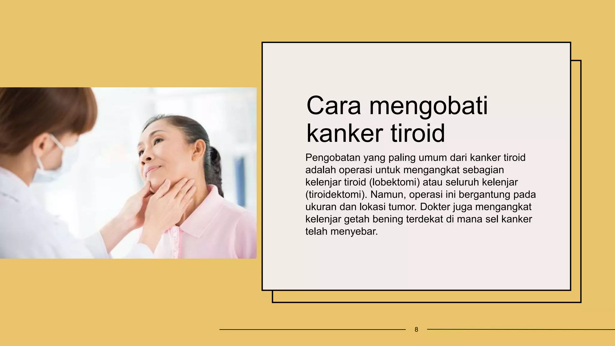 Kanker Tiroid.pptx