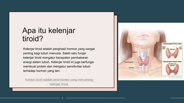 Kanker Tiroid.pptx