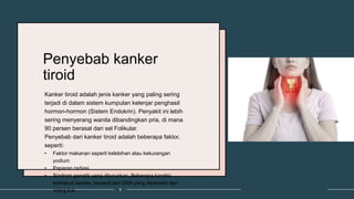 Kanker Tiroid.pptx