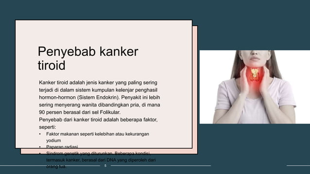 Kanker Tiroid.pptx