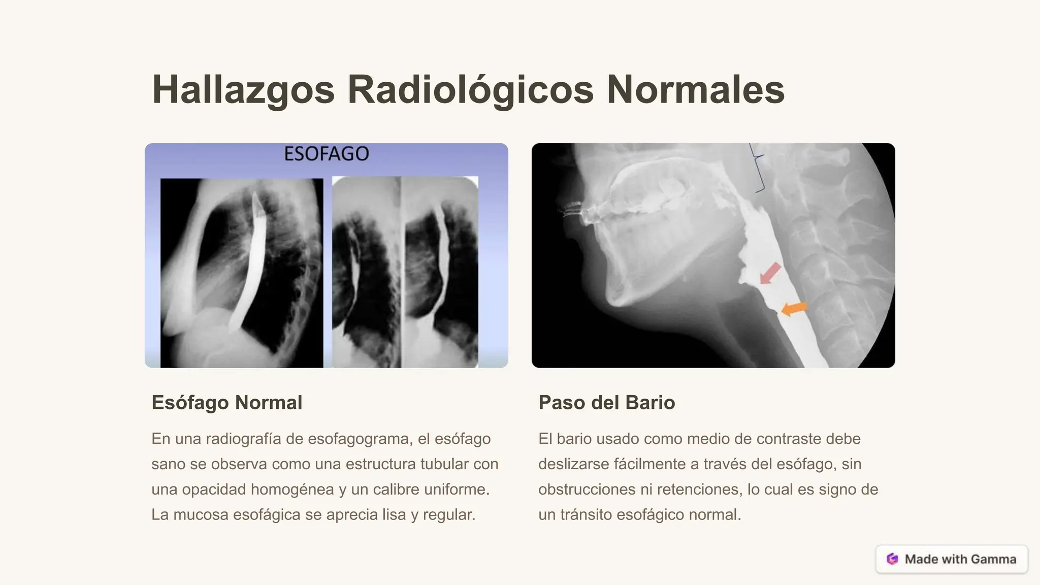 Introduccion al esofagograma y sus características | PPTX