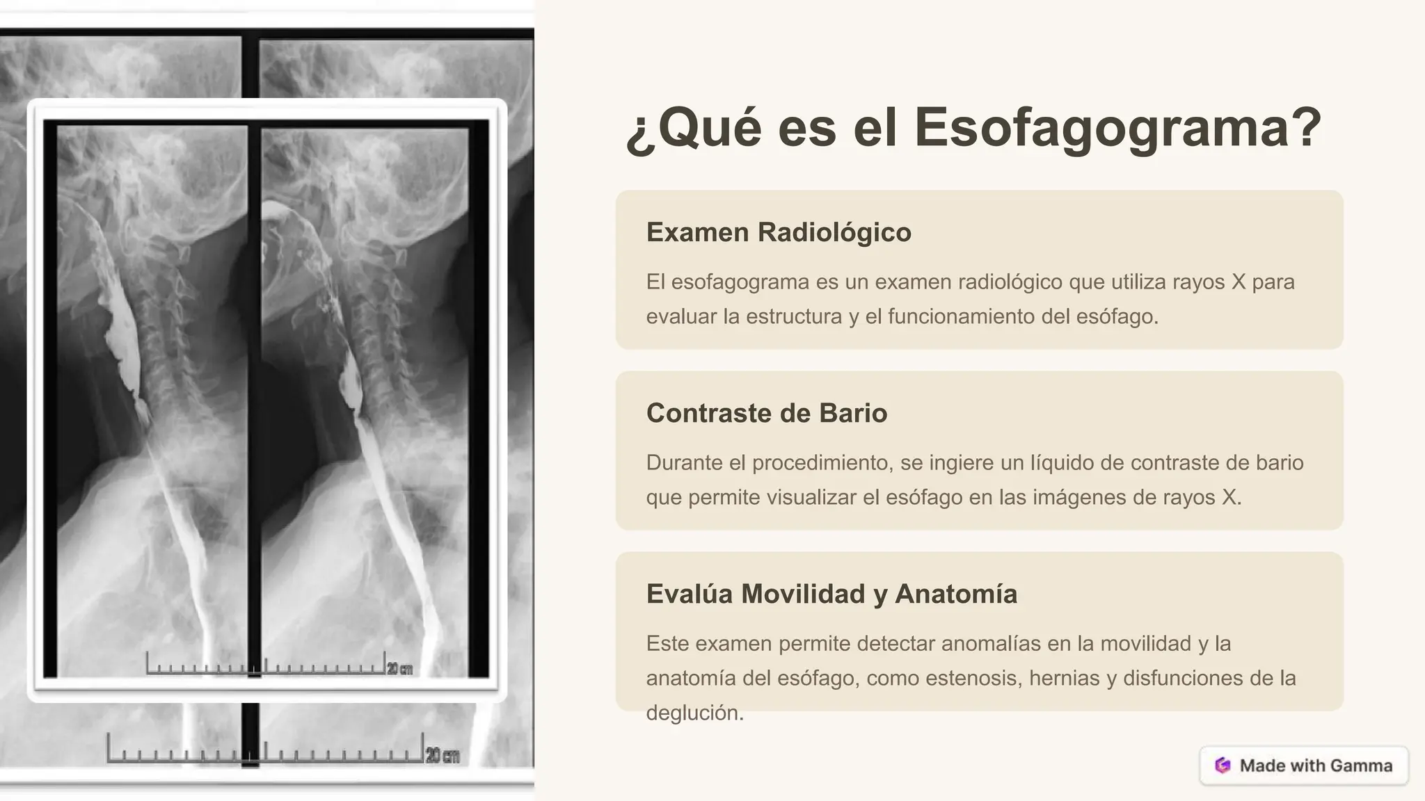 Introduccion al esofagograma y sus características | PPTX
