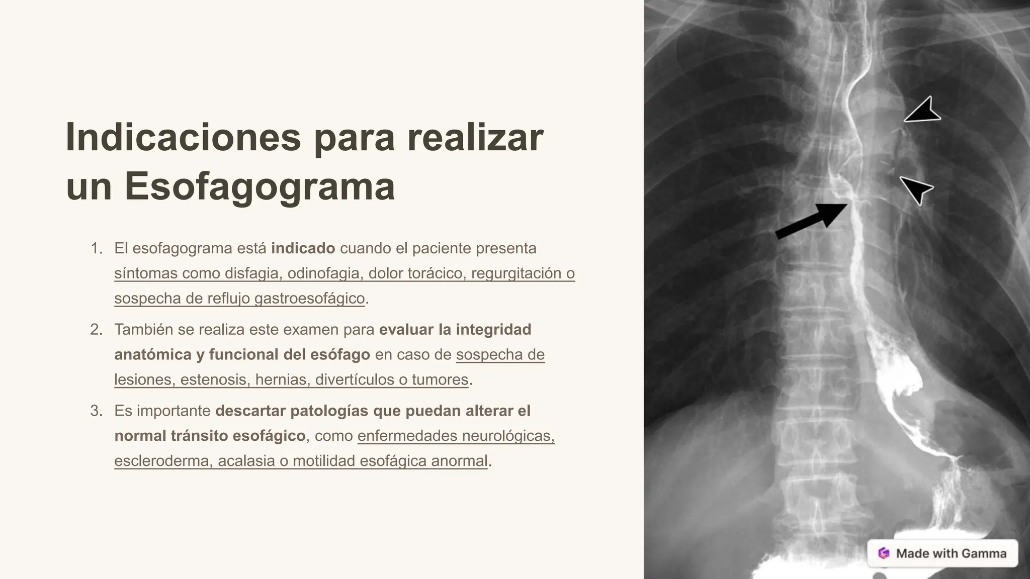 Introduccion al esofagograma y sus características | PPTX