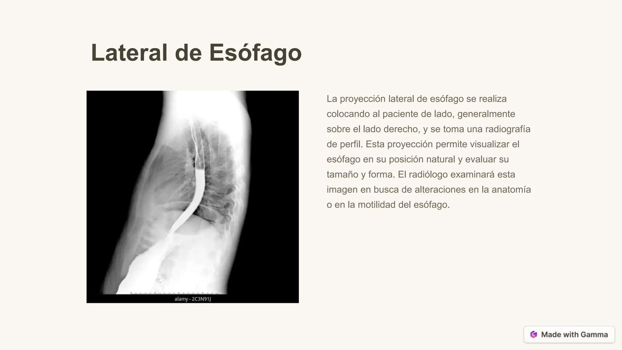 Introduccion al esofagograma y sus características | PPTX