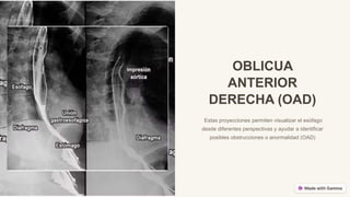 Introduccion al esofagograma y sus características | PPTX