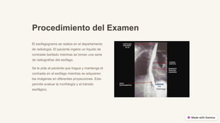 Introduccion al esofagograma y sus características | PPTX