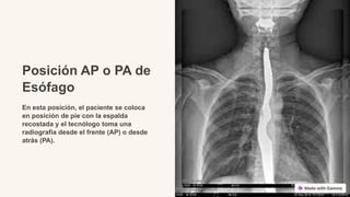 Introduccion al esofagograma y sus características | PPTX