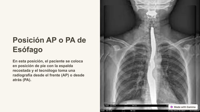 Introduccion al esofagograma y sus características | PPTX