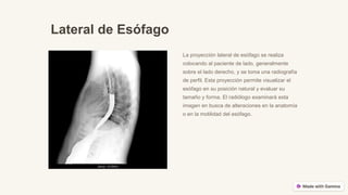 Introduccion al esofagograma y sus características | PPTX