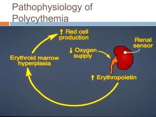 Polycythemia in newborn | PPTX