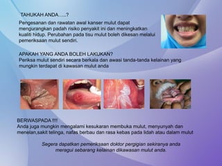Kanser-Mulut-Flipchart.pdf
