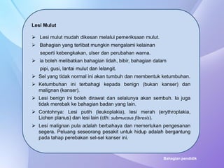 Kanser-Mulut-Flipchart.pdf