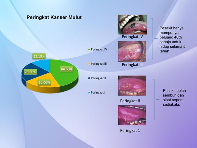 Kanser-Mulut-Flipchart.pdf