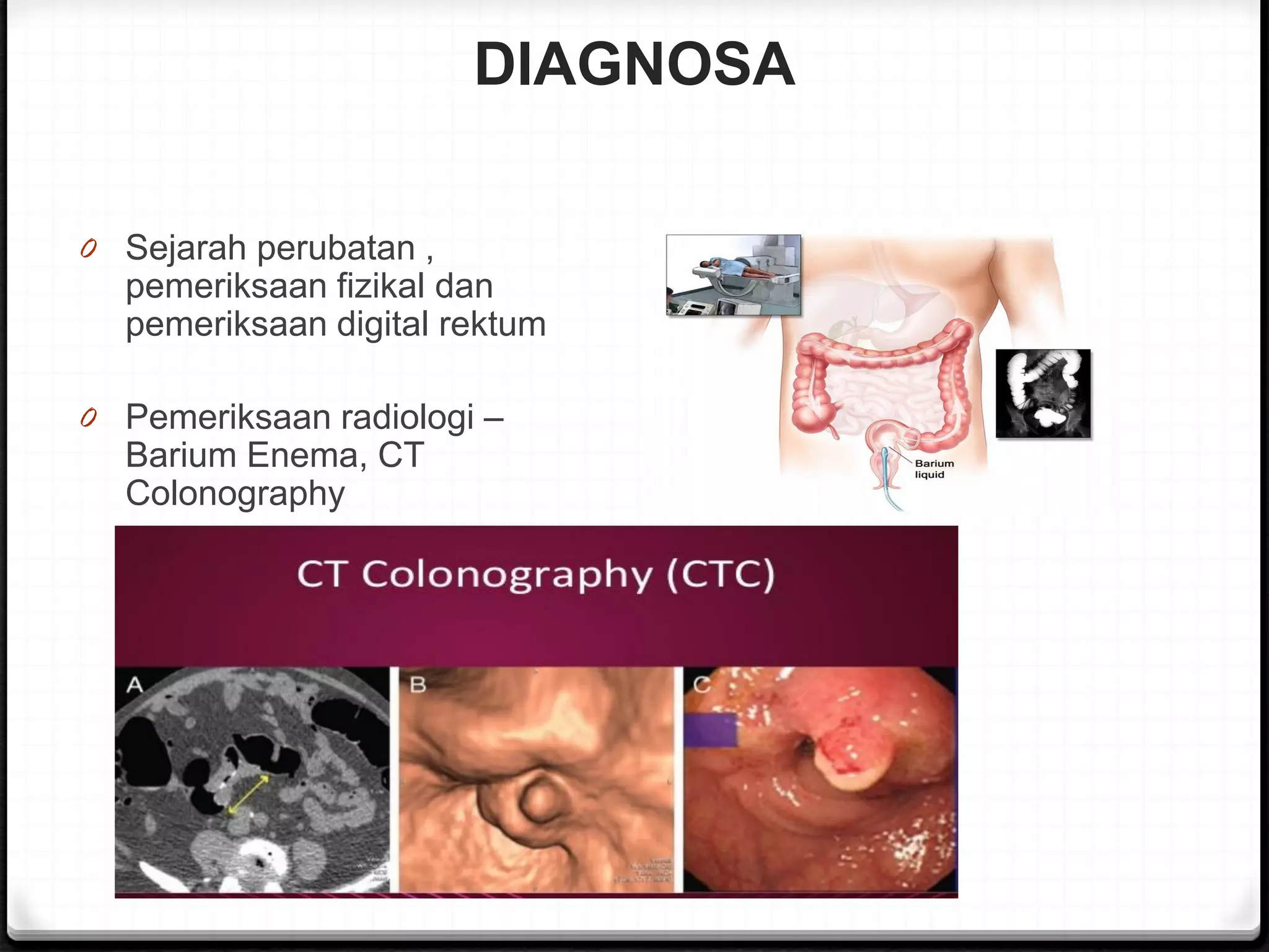 Kanser kolorektal | PDF