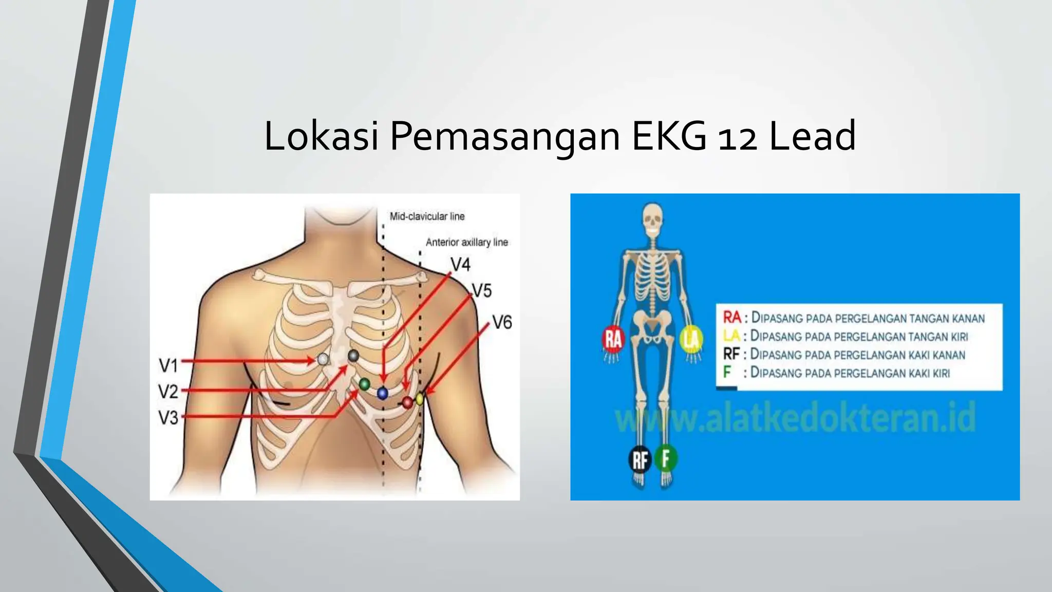 Kansiskoris Mahuze Jr_EKG Sederhana.pptx