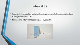 Kansiskoris Mahuze Jr_EKG Sederhana.pptx