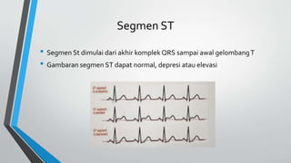 Kansiskoris Mahuze Jr_EKG Sederhana.pptx