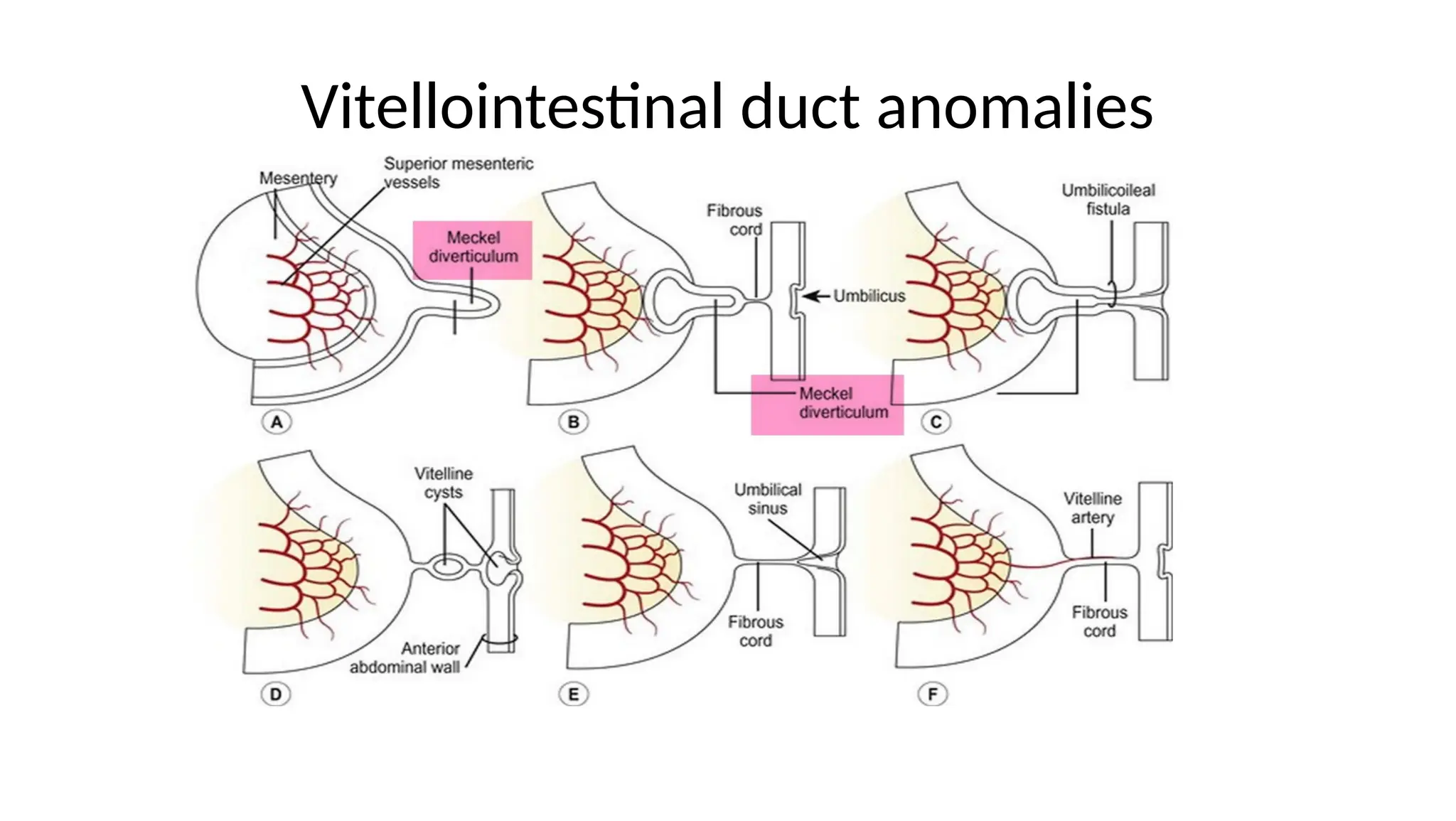 embryology of malformations with clinical references | PPTX