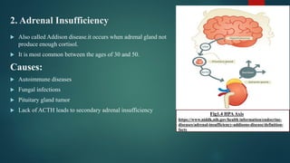 Disorder of adrenal gland & their causes | PPT