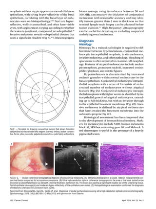 kao-et-al-2016-management-of-primary-acquired-melanosis-nevus-and ...
