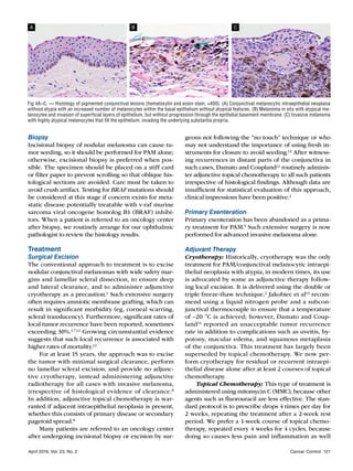 kao-et-al-2016-management-of-primary-acquired-melanosis-nevus-and ...
