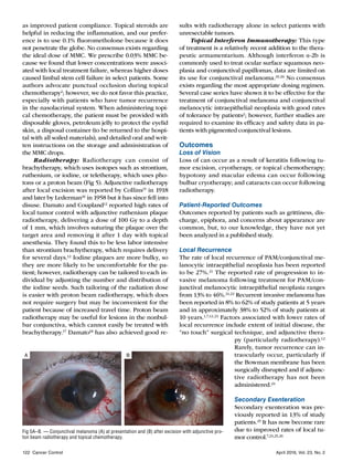 kao-et-al-2016-management-of-primary-acquired-melanosis-nevus-and-conjunctival-melanoma.pdf