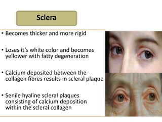 Age-related ocular anatomical and physiological || Kapil Gautam | PPTX