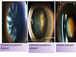 Age-related ocular anatomical and physiological || Kapil Gautam | PPTX