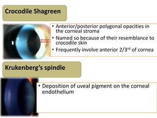Krukenberg Spindle Vs Asteroid Hyalosis