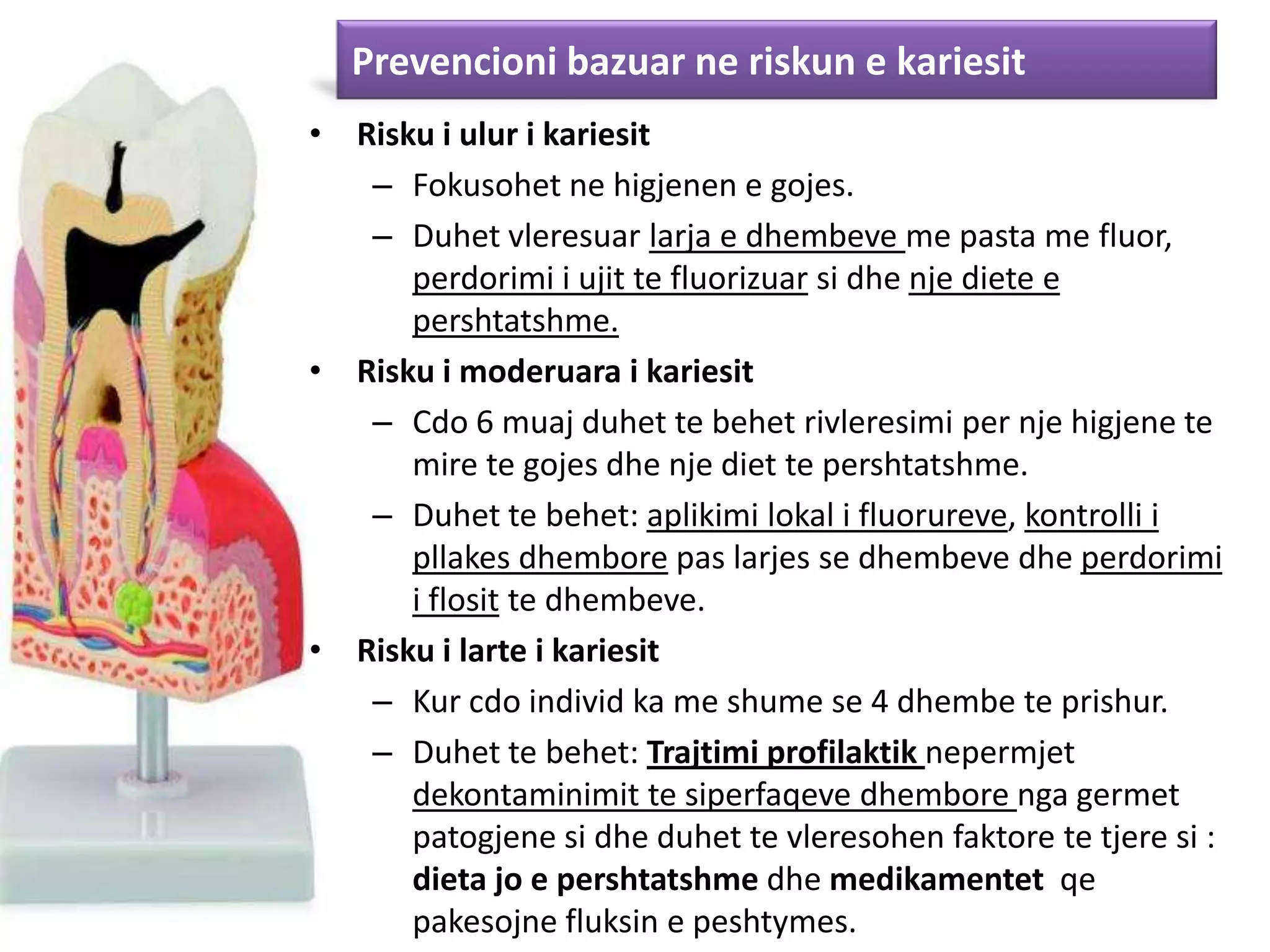 Kariesi i dhembeve dhe parandalimi i bazuar ne riskun e kariesit | PPTX