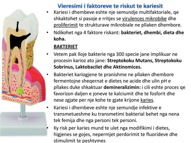 Kariesi i dhembeve dhe parandalimi i bazuar ne riskun e kariesit | PPTX