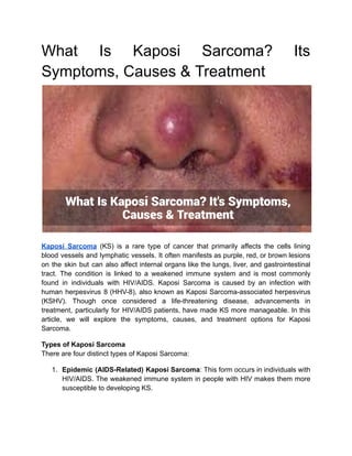 What Is Kaposi Sarcoma? Its Symptoms, Causes & Treatment | PDF