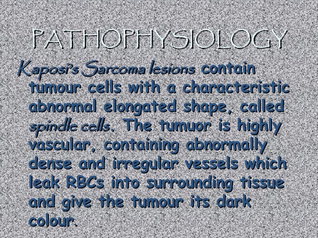 KAPOSI'S SARCOMA.ppt. . | PPT