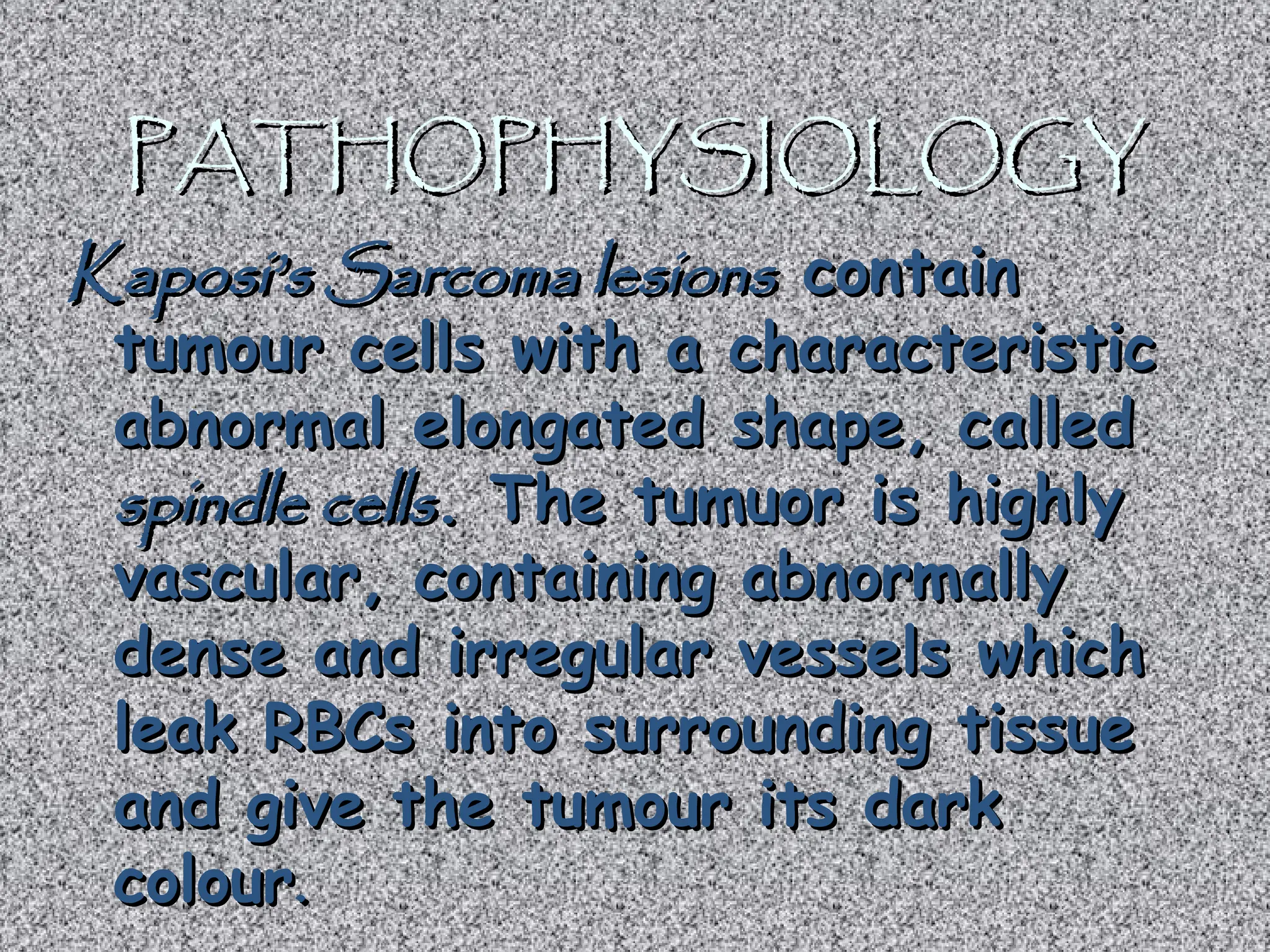 KAPOSI'S SARCOMA.ppt. . | PPT