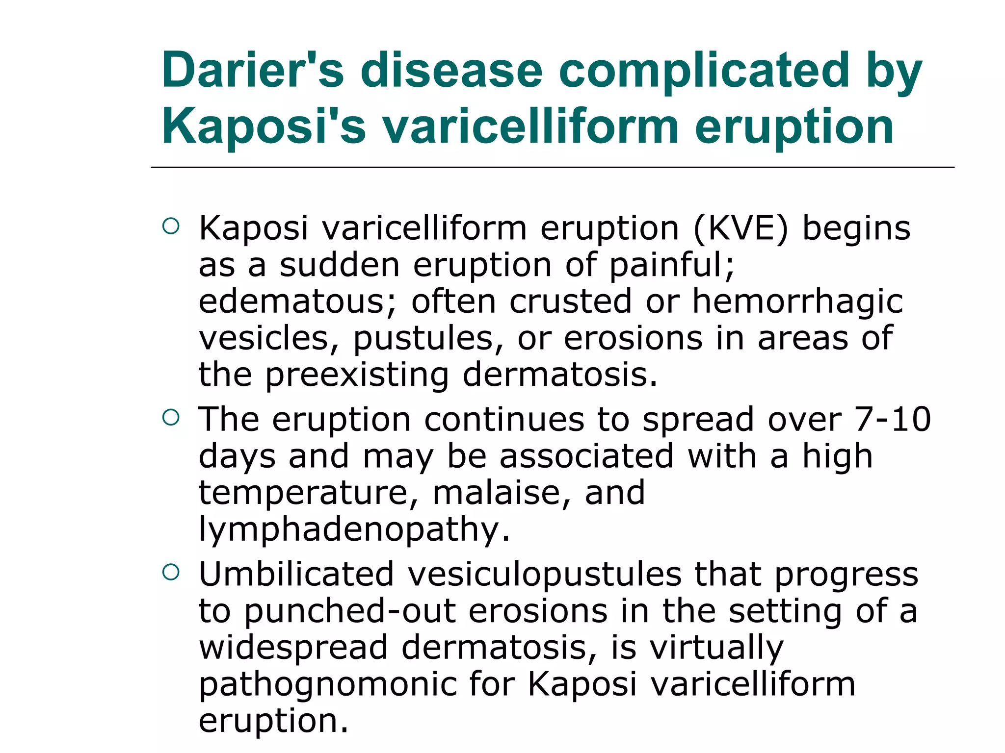 Kaposi variceliform erupcion | PPT