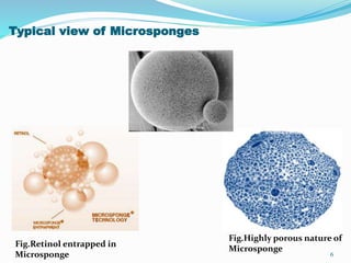 Microsponge Drug Delivery System | PPTX